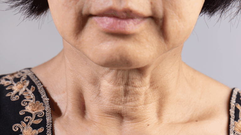 Sagging Skin Treatment in Singapore - Nueva Clinic